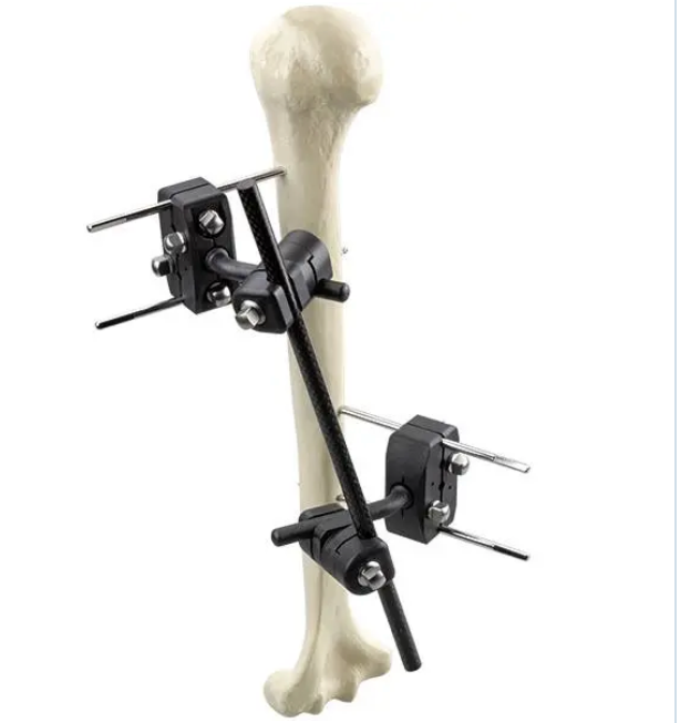Φ8.0 Series External Fixation Fixator – Humerus Backbone Frame – IMC ...